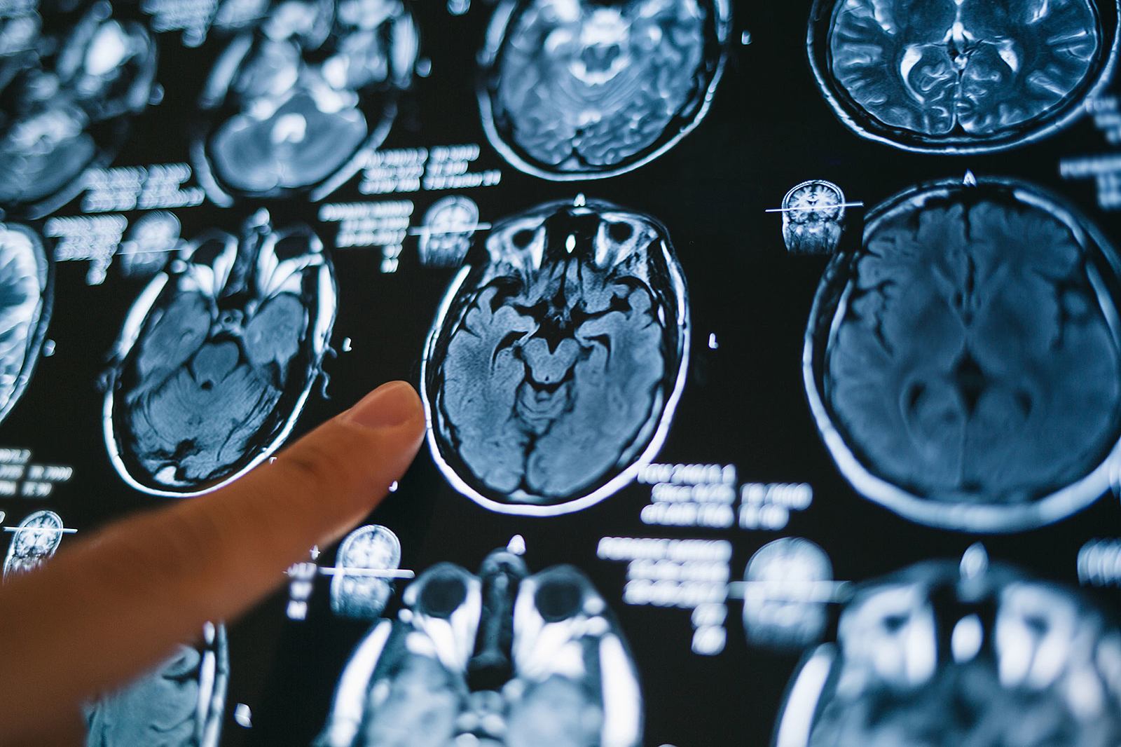 Radiology Using the Latest Technology - Helena Medical Group
